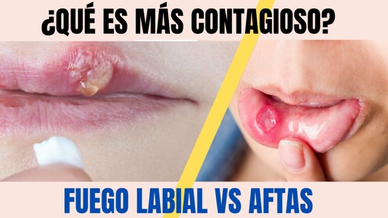 Como Quitar una Ampolla Del Labio - Educación para Padres e Hijos