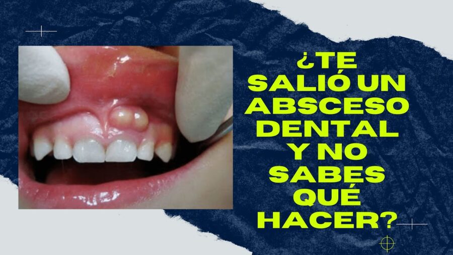 Descubre qué es bueno para la postemilla y cómo tratarla de forma ...