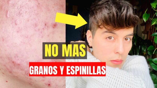 Descubre cómo eliminar las espinillas en tu cara con estos increíbles ...