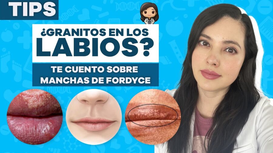 Descubre qué son y cómo tratar los puntos blancos en los labios ...
