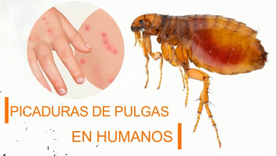Pulgas en humanos: ¿Cómo evitar que se peguen y cómo deshacerse de ...