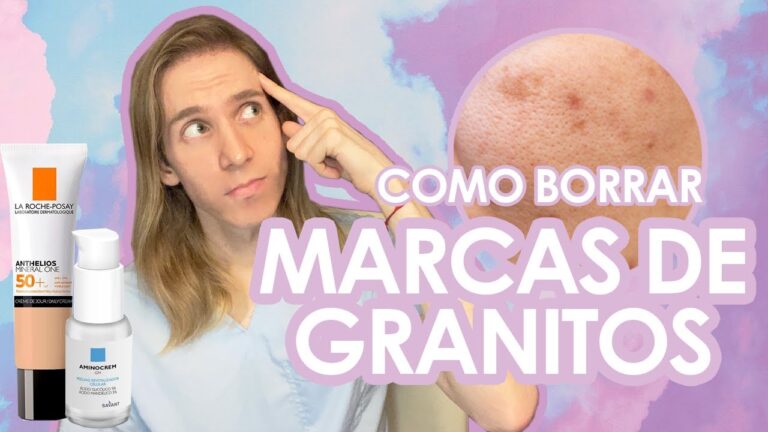 Descubre cómo eliminar las manchas de granos de forma natural: consejos ...