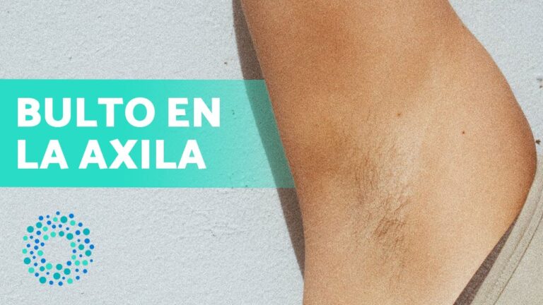 Todo lo que necesitas saber sobre el bulto interno en la axila con ...