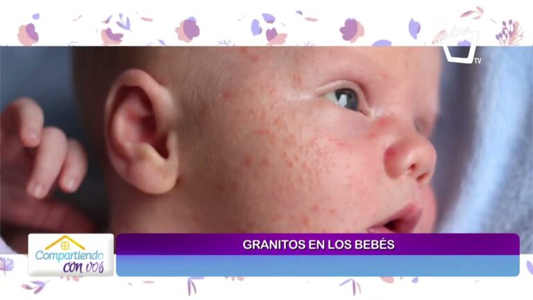 Descubre por qué los bebés tienen granos en su piel: causas y ...