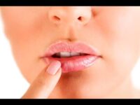 5 métodos efectivos para eliminar rápidamente una ampolla en el labio ...