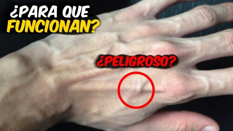 Descubre las causas y soluciones para los bultos en las venas de las ...